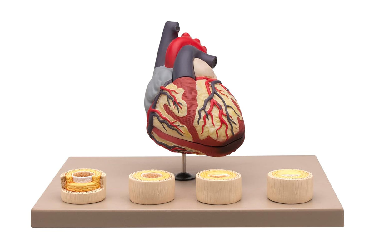Heart: Heart Condition Model – The Science Bank